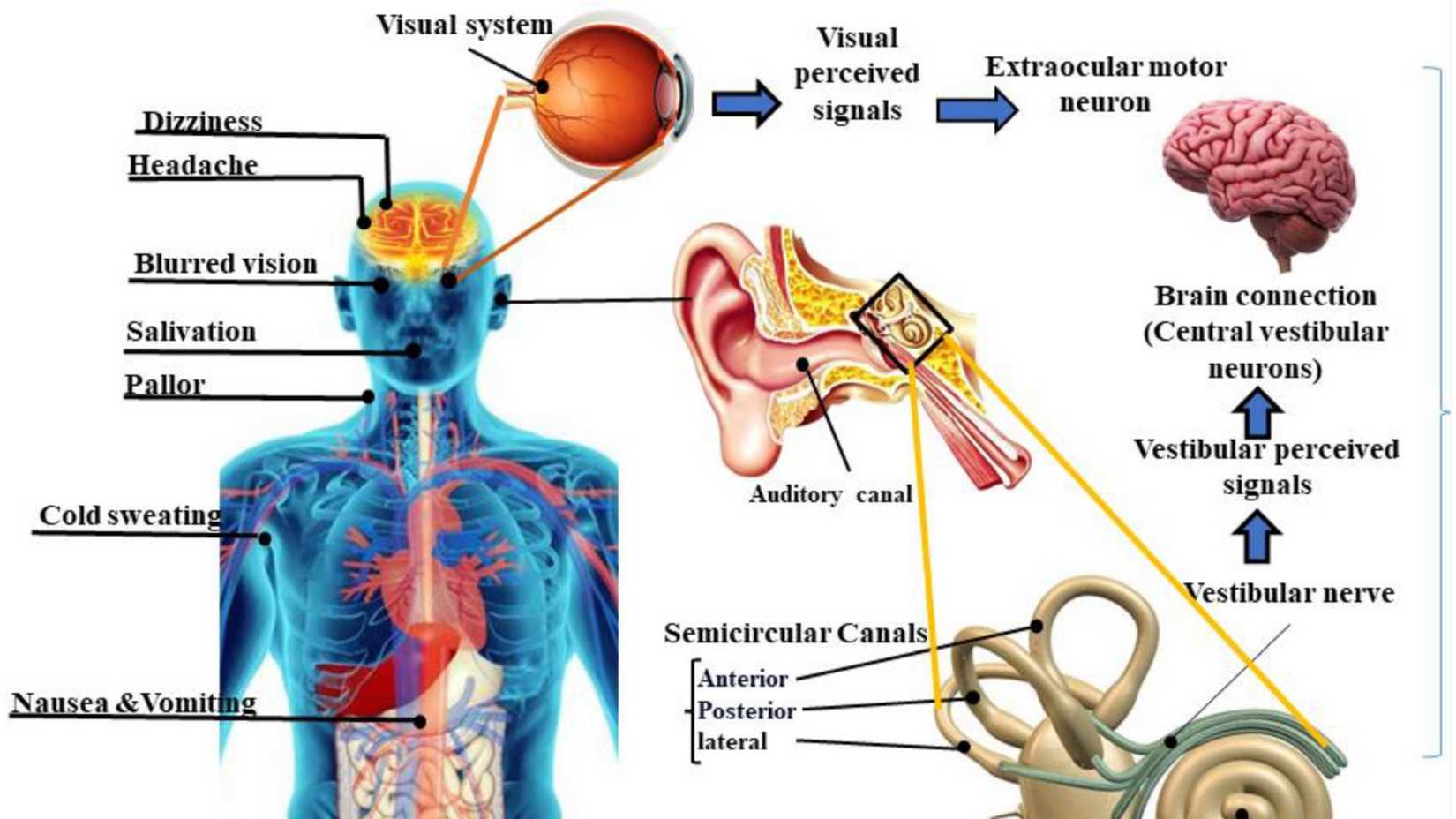 Motion Sickness Could be Cured With Sound